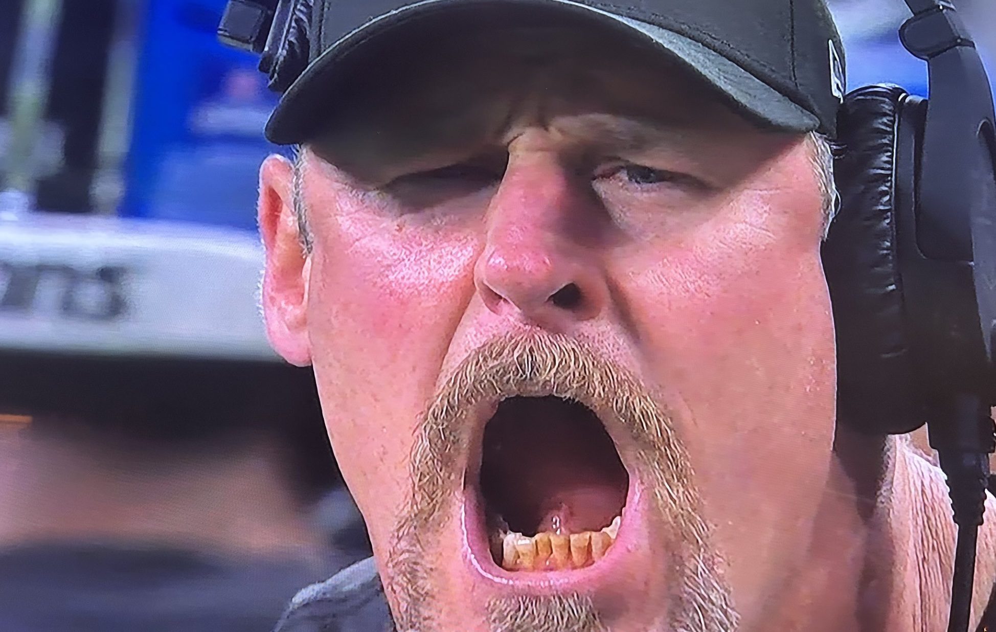 Detroit Lions Coach Dan Campbell Offered A Lifetime Supply Of Teeth ...